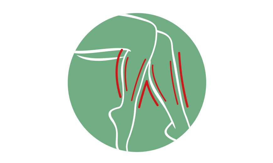 Paroven | Our Solution | Paroven